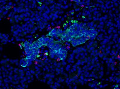 Diabetes Discovery [IMAGE] | EurekAlert! Science News Releases