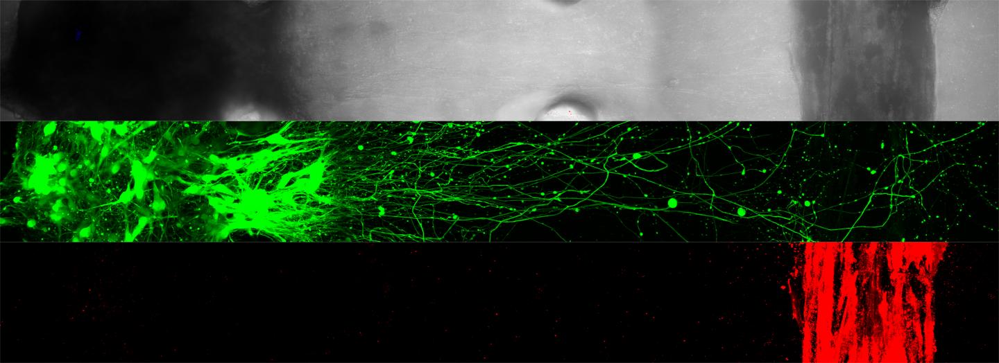 Light-Activated, Bioengineered Neuromuscular | EurekAlert!