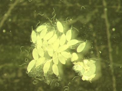 Fly Bacteria Protects Against Infertility (5 | EurekAlert!