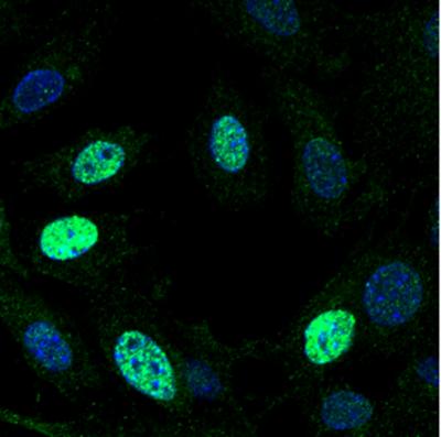 Protein's Dual Role Implicated in Cell Starva | EurekAlert!