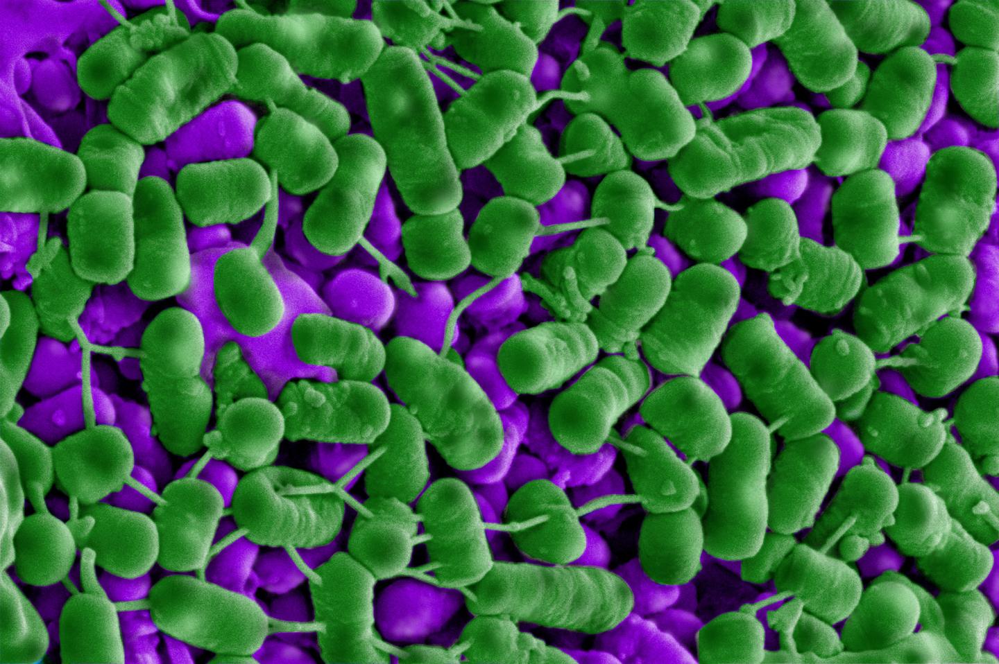 Listeria Bacteria [IMAGE] | EurekAlert! Science News Releases