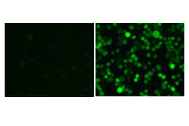 New receptor found on scavenger cells | EurekAlert!