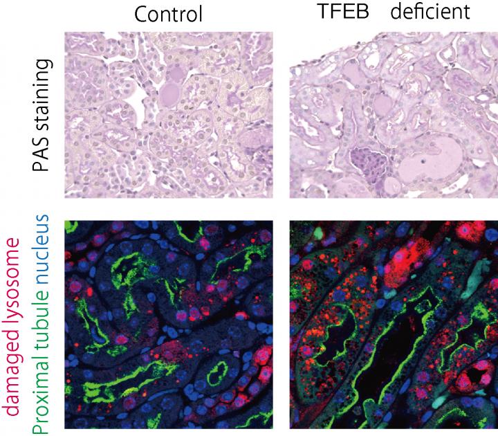 Figure 2. Functional TFEB is r [IMAGE] | EurekAlert! Science News Releases