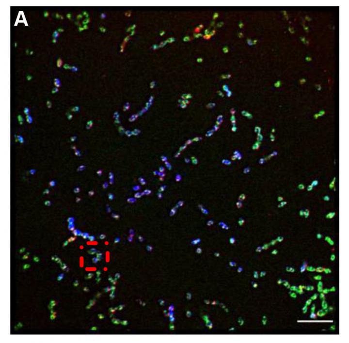 Switching 'Sticky' Molecules Allows Bacteria | EurekAlert!