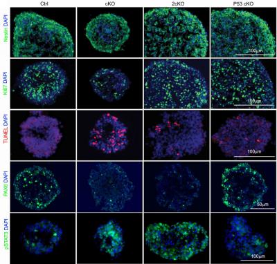 Importance of FIP200 to Neural [IMAGE] | EurekAlert! Science News Releases
