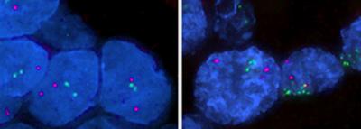 Gene Positions in Normal vs. C [IMAGE] | EurekAlert! Science News Releases