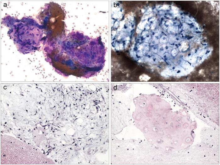 The World Health Organization reporting syste | EurekAlert!