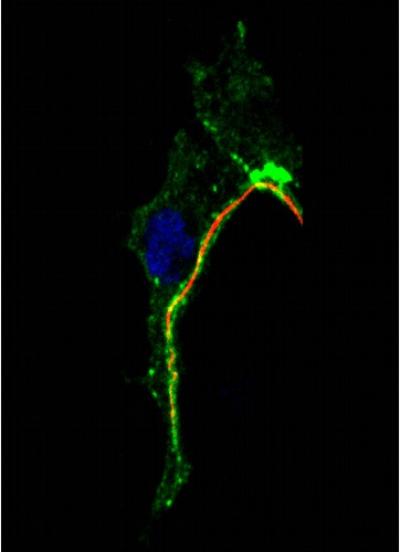 A study reveals how respiratory tubes and cap | EurekAlert!