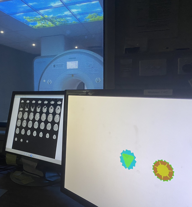 Learning behavior differs between OCD and pro | EurekAlert!