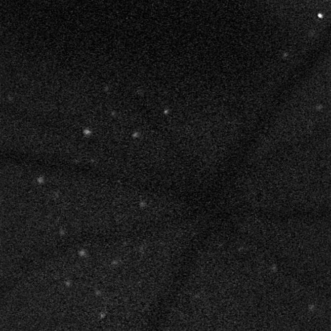 Starry, Starry Retina [IMAGE] | EurekAlert! Science News Releases