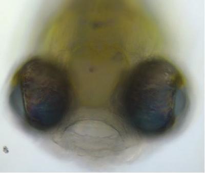 Normal Face [IMAGE] | EurekAlert! Science News Releases