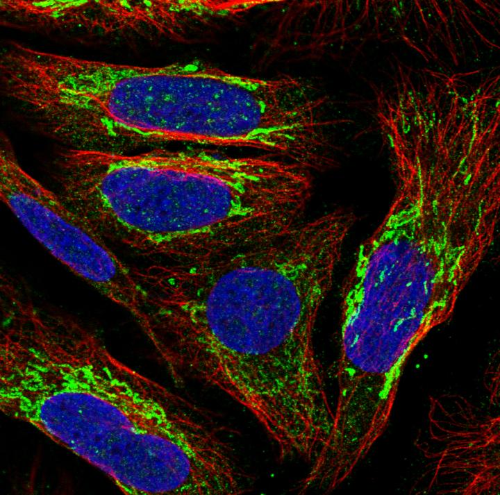 New Map Tracks Protein Expression in Human Ti | EurekAlert!