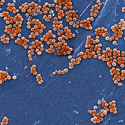 MRSA Bacteria [IMAGE] | EurekAlert! Science News Releases