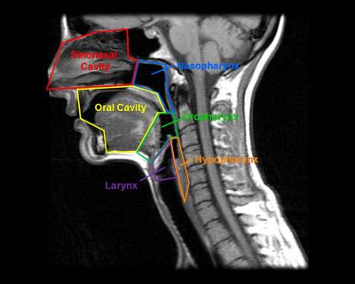 The Genomic Landscape of Head [IMAGE] | EurekAlert! Science News Releases