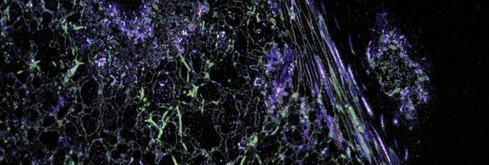 Scan of a lettuce leaf at the [IMAGE] | EurekAlert! Science News Releases