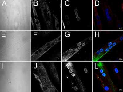 Dystrophin and Utrophin [IMAGE] | EurekAlert! Science News Releases