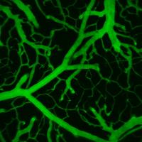 Controlling Inflated Blood Vessels (1 of 7) | EurekAlert!