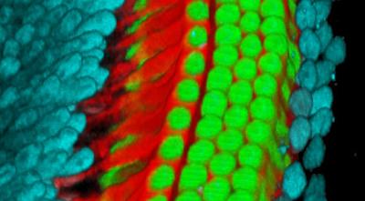 Microscopic View of Murine Ear [IMAGE] | EurekAlert! Science News Releases