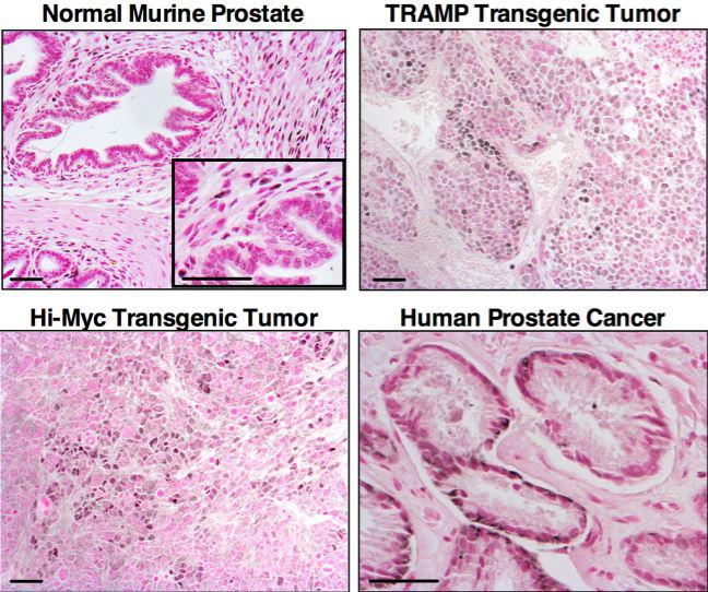 Out-FOXing Prostate Cancer [IMAGE] | EurekAlert! Science News Releases