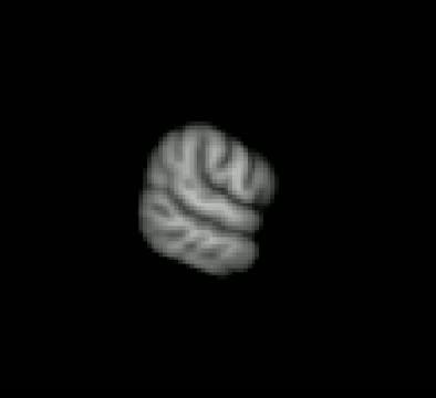 Brain structure may be root of apathy | EurekAlert!