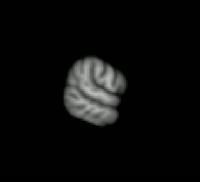 Brain structure may be root of apathy | EurekAlert!