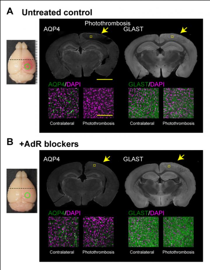 A new treatment for stroke in mice reduces br | EurekAlert!