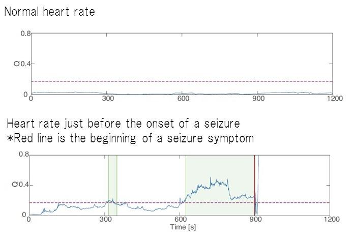 Analysis of Heart Rate Variabi [IMAGE] | EurekAlert! Science News Releases