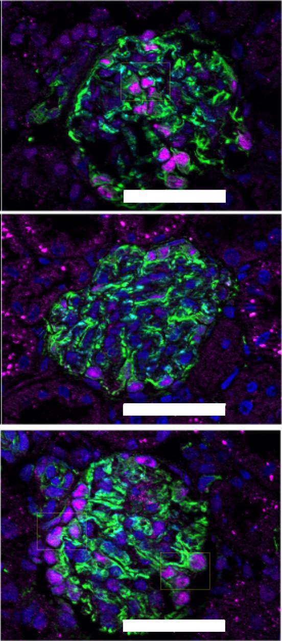 Intricate Cell 'Foot Work' Pre [IMAGE] | EurekAlert! Science News Releases