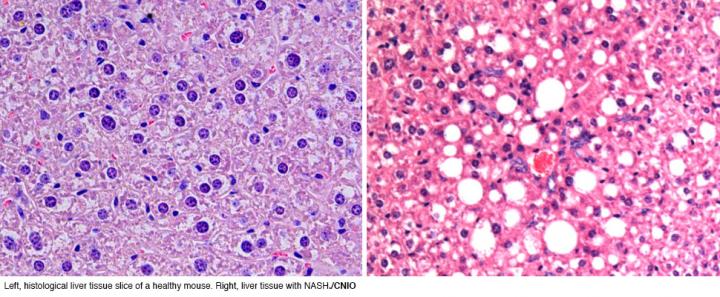 Liver Tissue [IMAGE] | EurekAlert! Science News Releases