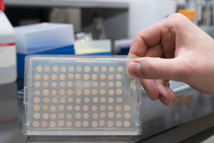 yeast cell sample plate [IMAGE] | EurekAlert! Science News Releases