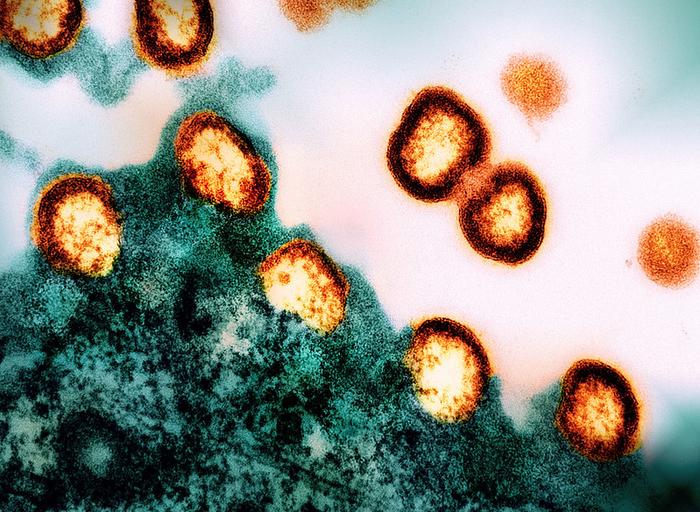 HIV-1 virus particles [IMAGE] | EurekAlert! Science News Releases