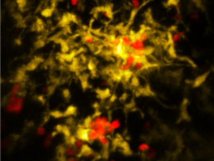 Infection defense: Call for support by the ki | EurekAlert!