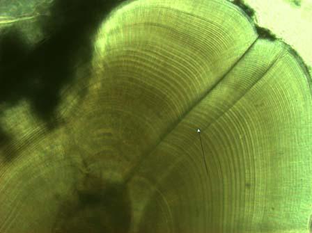 Flounder Otolith [IMAGE] | EurekAlert! Science News Releases