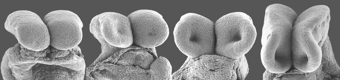 Mouse neural folds [IMAGE] | EurekAlert! Science News Releases