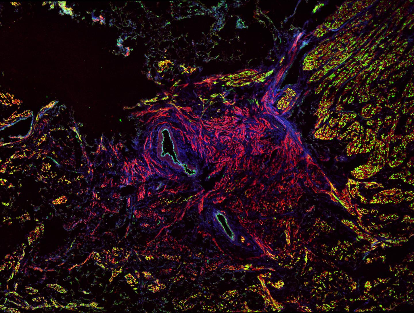 Backup Pacemakers Let the Heart Take a Thumpi | EurekAlert!