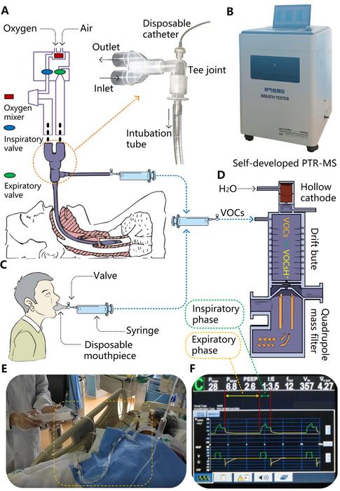 Researchers screen for ventilator associated | EurekAlert!