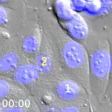 Cannibal cells may limit cancer growth | EurekAlert!