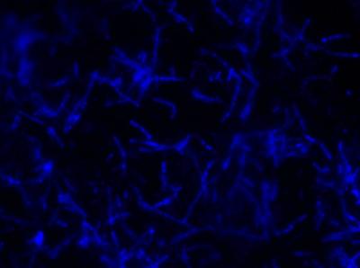 DAPI Bacteria [IMAGE] | EurekAlert! Science News Releases