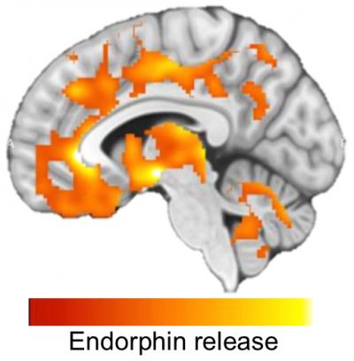 HIIT releases endorphins in the brain | EurekAlert!