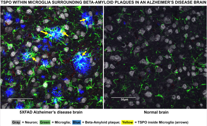 Tspo Within Microglia Surround [image] Eurekalert Science News Releases