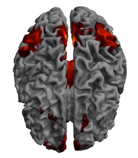 Resting State Functional Mri [image] Eurekalert Science News Releases