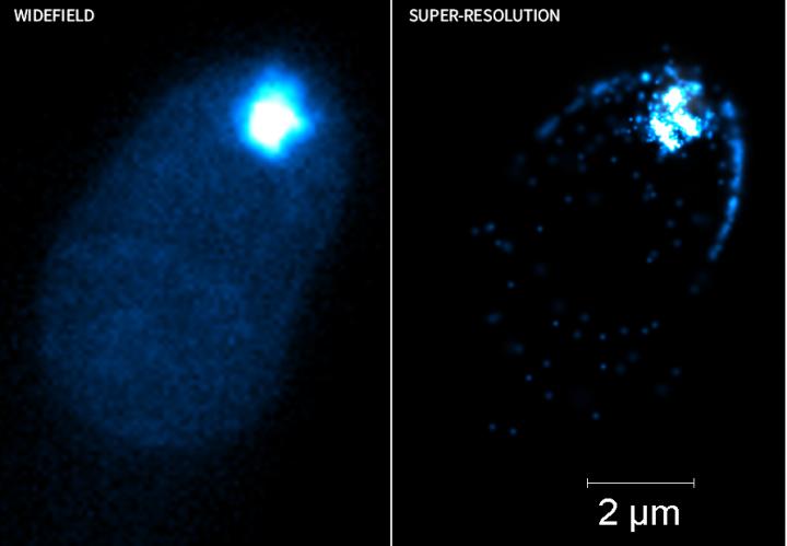 Super-Resolution Microscopy [IMAGE] | EurekAlert! Science News Releases
