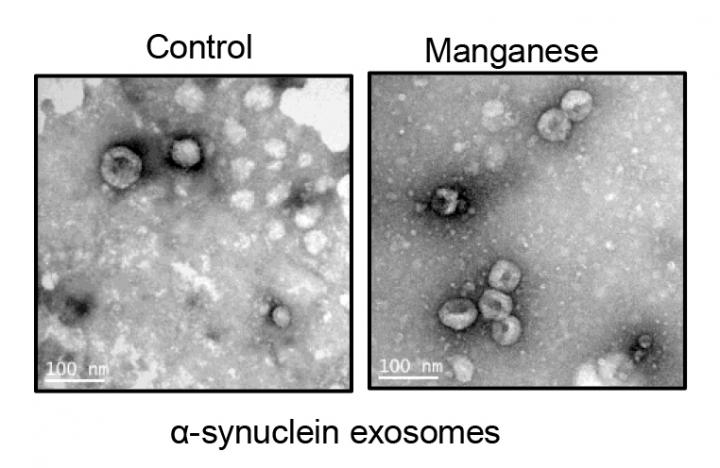 Manganese Exposure Boosts the Spread of a Neu | EurekAlert!