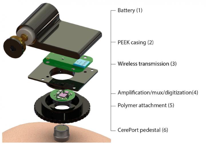 Wireless Neurosensor [IMAGE] | EurekAlert! Science News Releases
