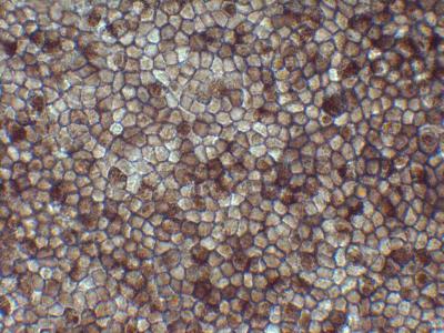 Retinal Pigment Epithelium Cel [IMAGE] | EurekAlert! Science News Releases