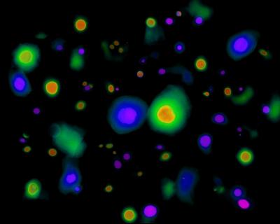 Possible Cosmic Defect, A Window Into Early U | EurekAlert!