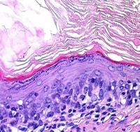 First step: From human cells to tissue-engine | EurekAlert!