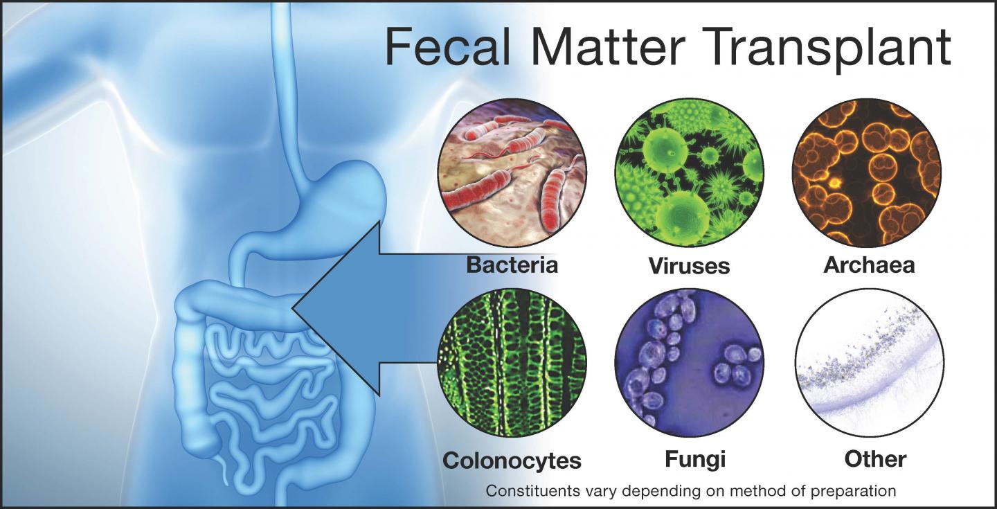 These days fecal transplantation is no joke | EurekAlert!