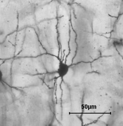 Spiny Stellate Cell [IMAGE] | EurekAlert! Science News Releases