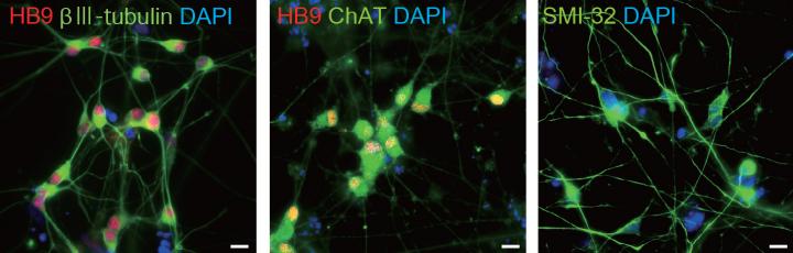 New System for Studying Amyotr [IMAGE] | EurekAlert! Science News Releases